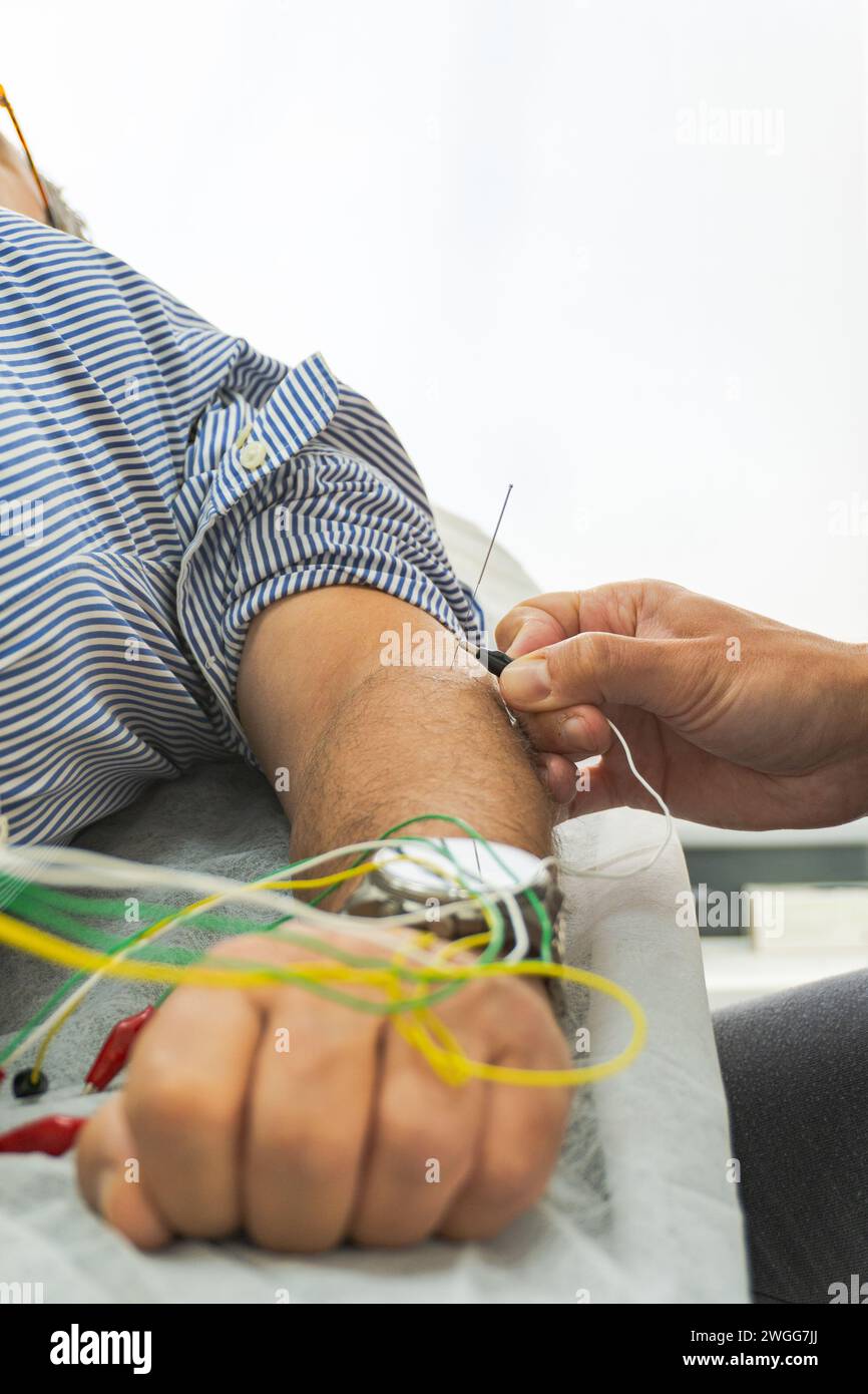 Dry needling hi-res stock photography and images - Alamy