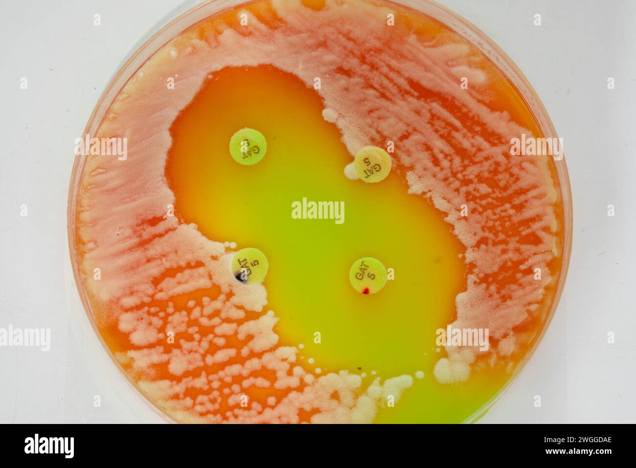 Bacteria colonies on agar hi-res stock photography and images - Alamy