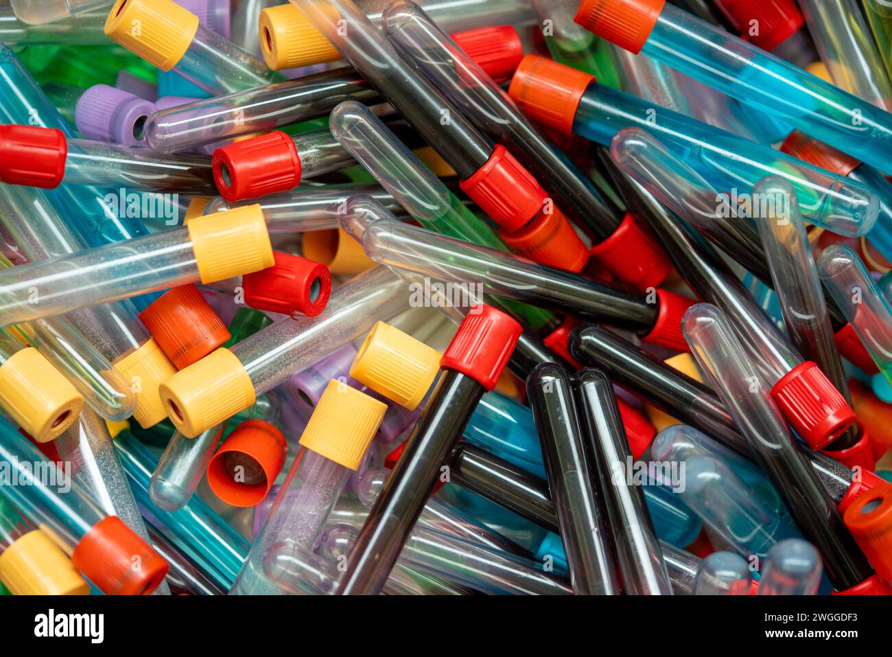 test tubes with hazardous biological substances in a microbiological ...
