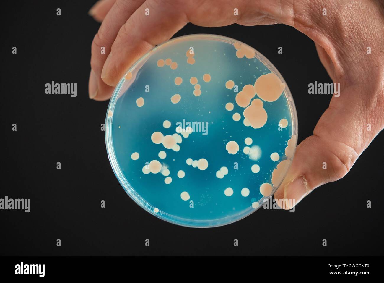 colonies of bacteria and microorganisms on the surface of agar and wind ...