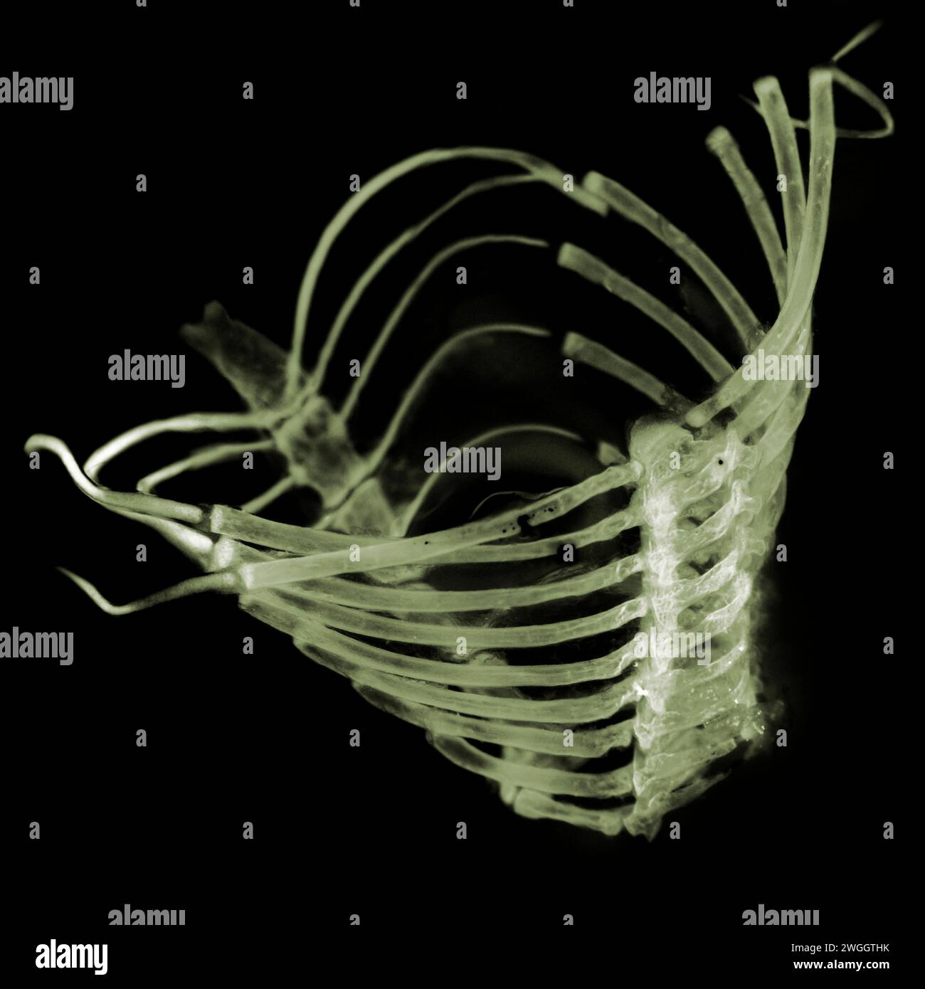 Skeletal prep hi-res stock photography and images - Alamy