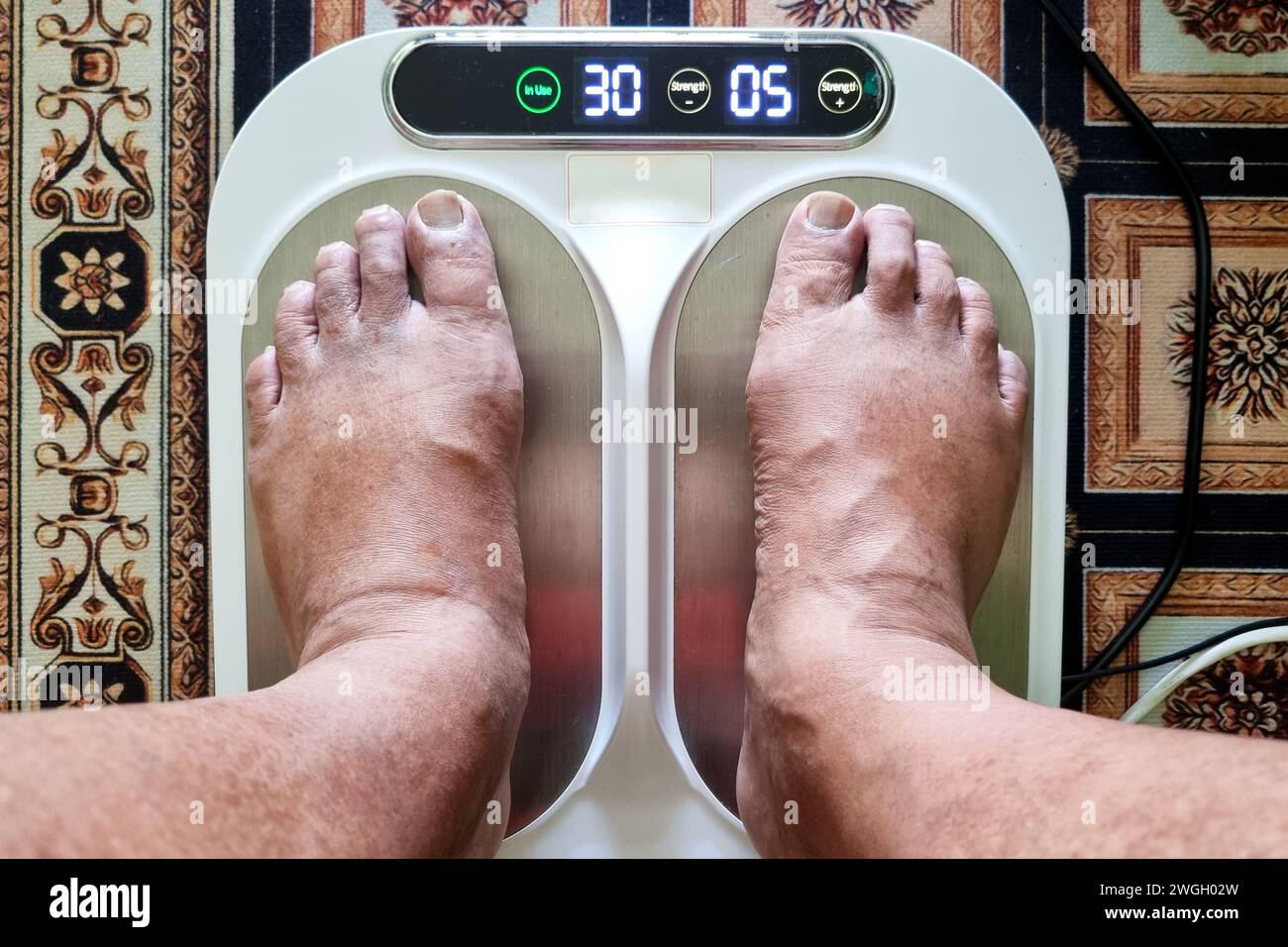 Closeup of person feet receiving magnetic therapy from electricity ...