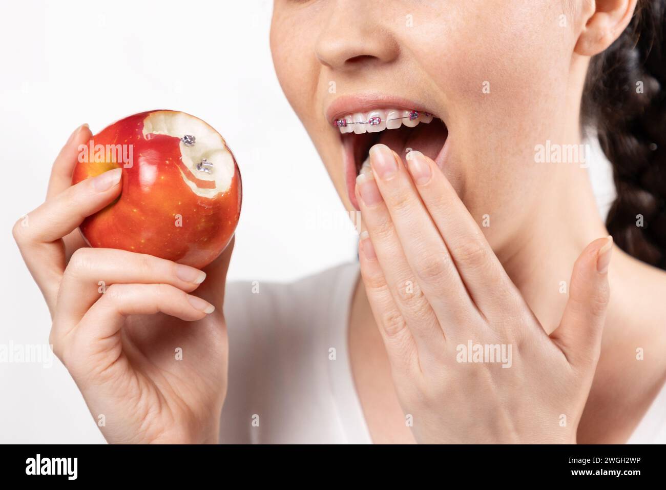 Close up of shocked woman with braces shows red apple with lost ...