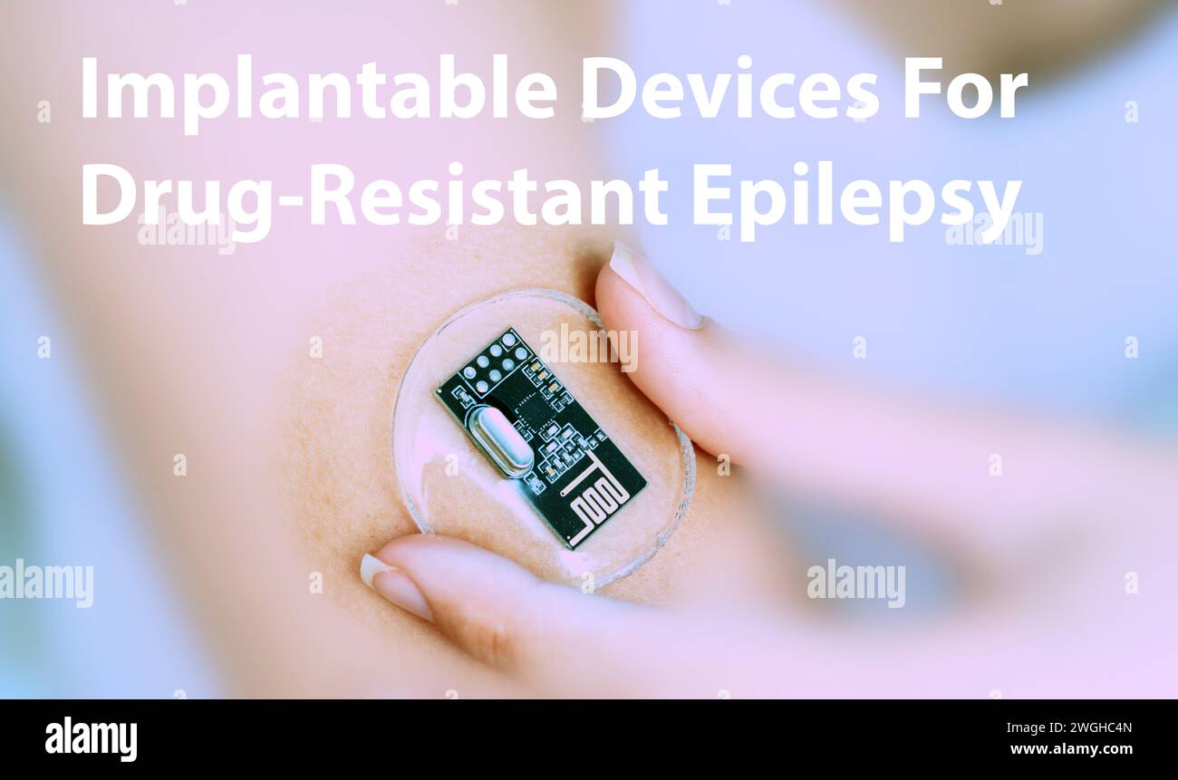Implantable devices for drug-resistant epilepsy: Devices that deliver ...