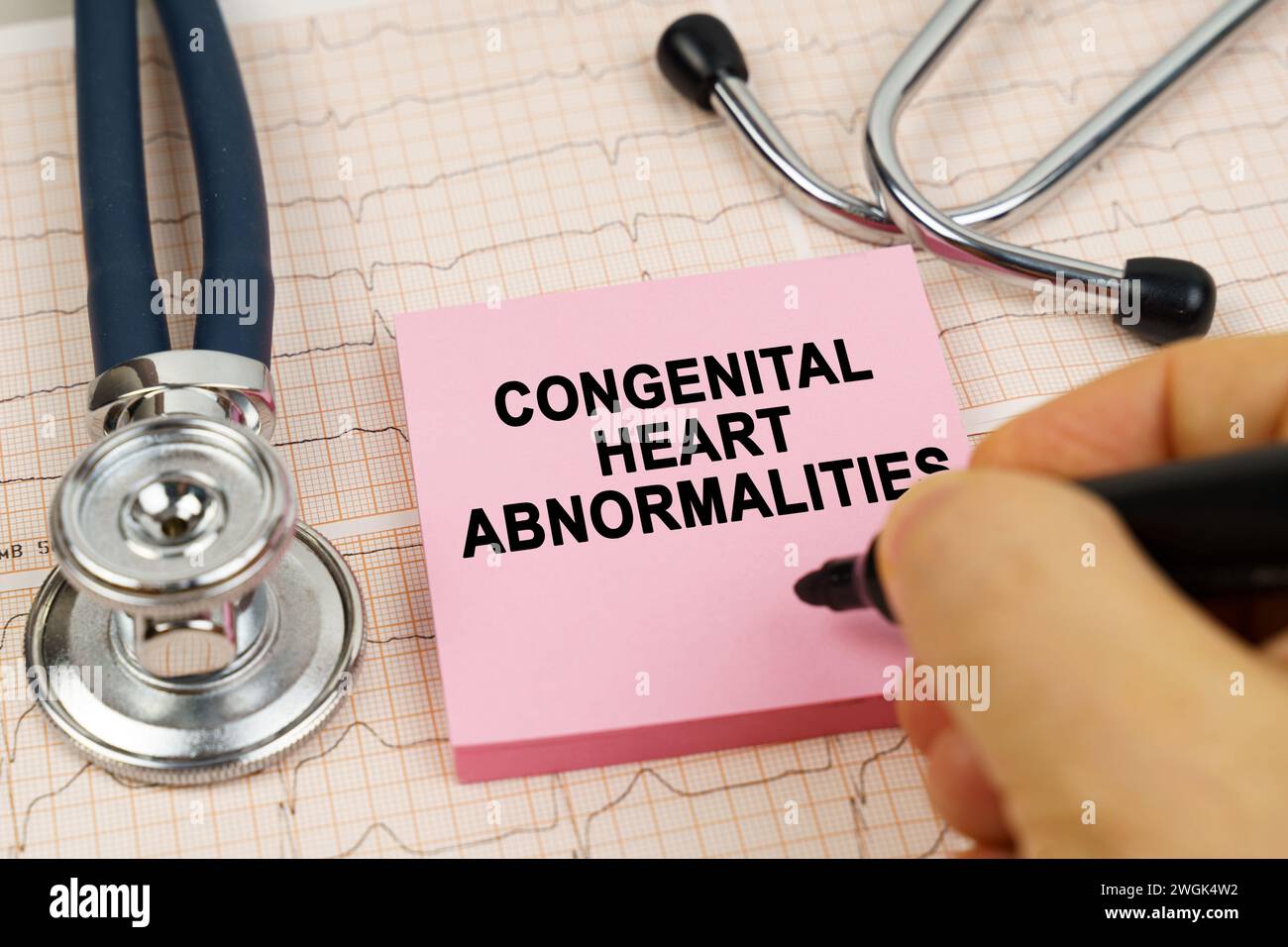 Medical concept. On the cardiograms there is a stethoscope and a ...