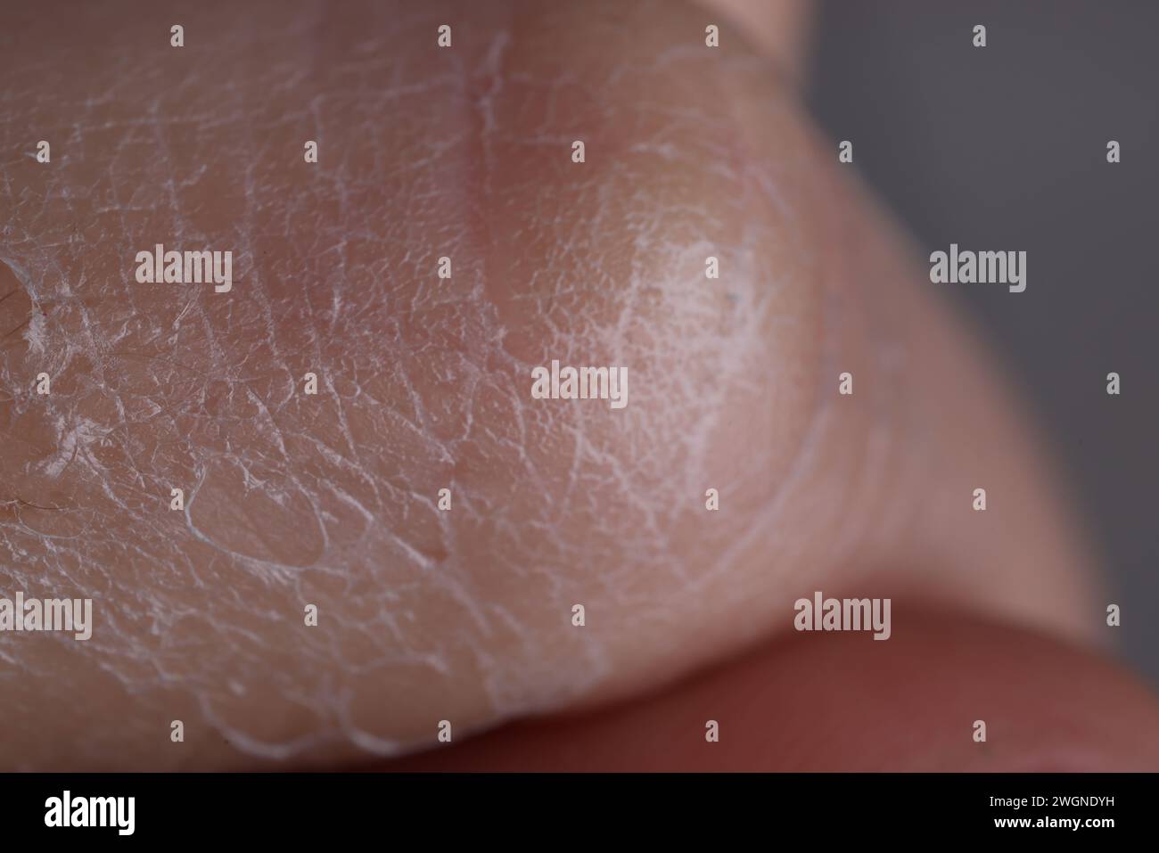 Closeup view woman finger dry hi-res stock photography and images - Alamy