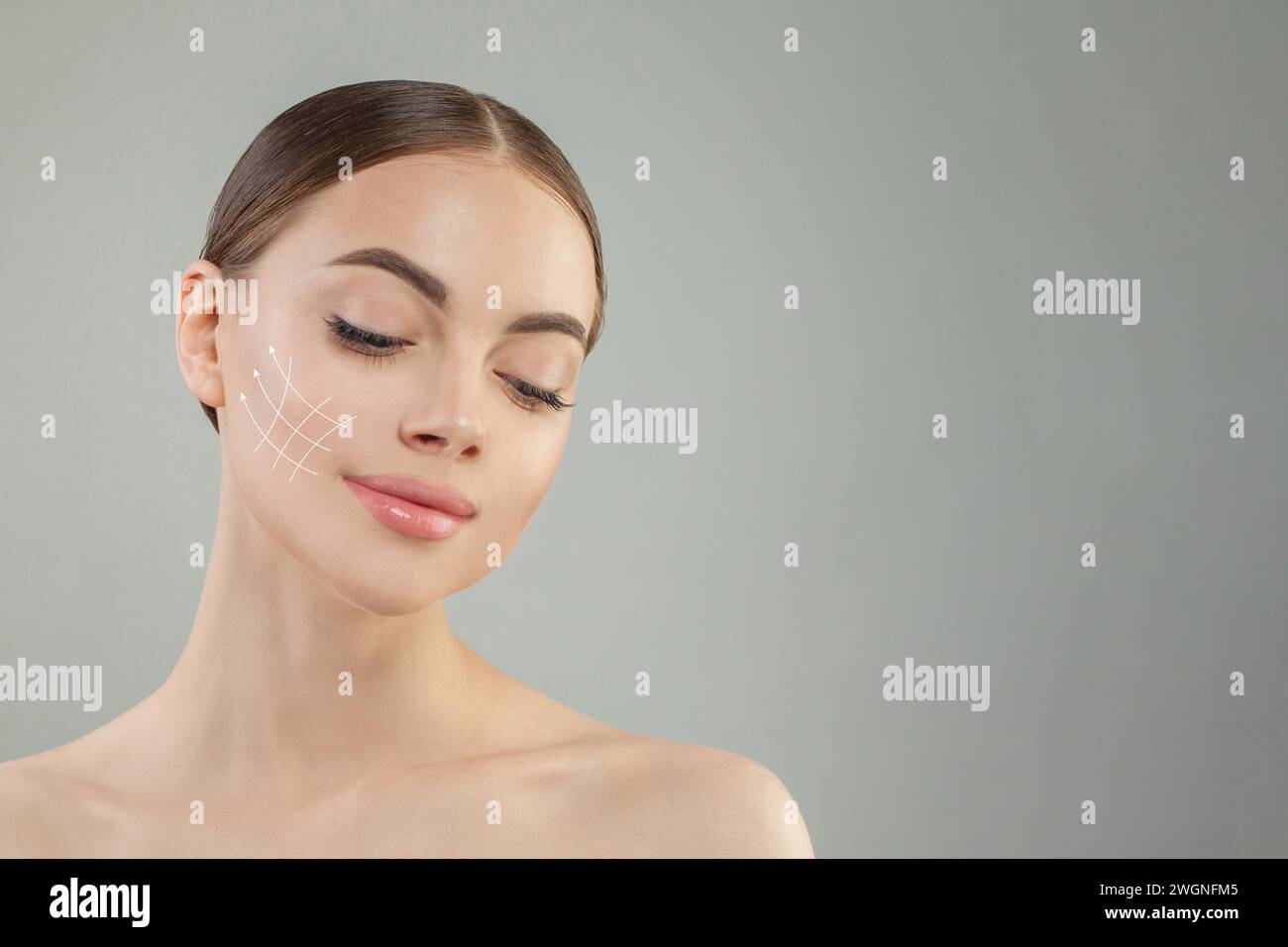 Young adult woman. Face lift anti-aging lines on young female face ...