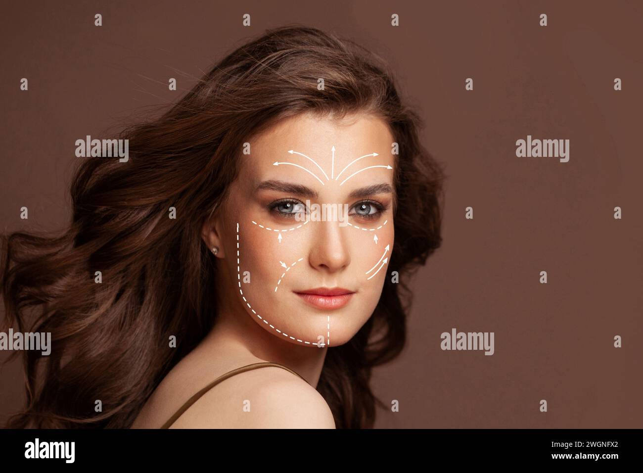 Surgery and Anti Aging Concept. Beauty Woman with Lifting Arrows on hr ...