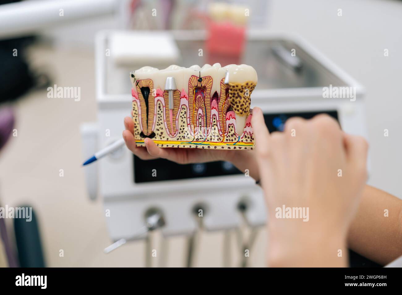 Detail cropped shot of unrecognizable female dentist holding teeth gum ...