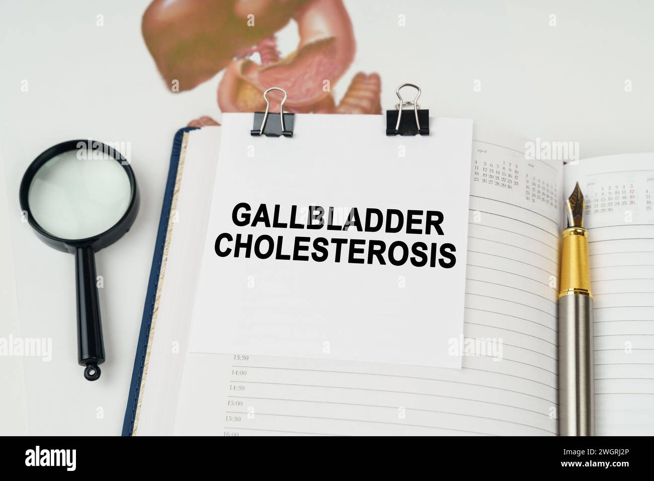 Gallbladder cholesterosis hi-res stock photography and images - Alamy