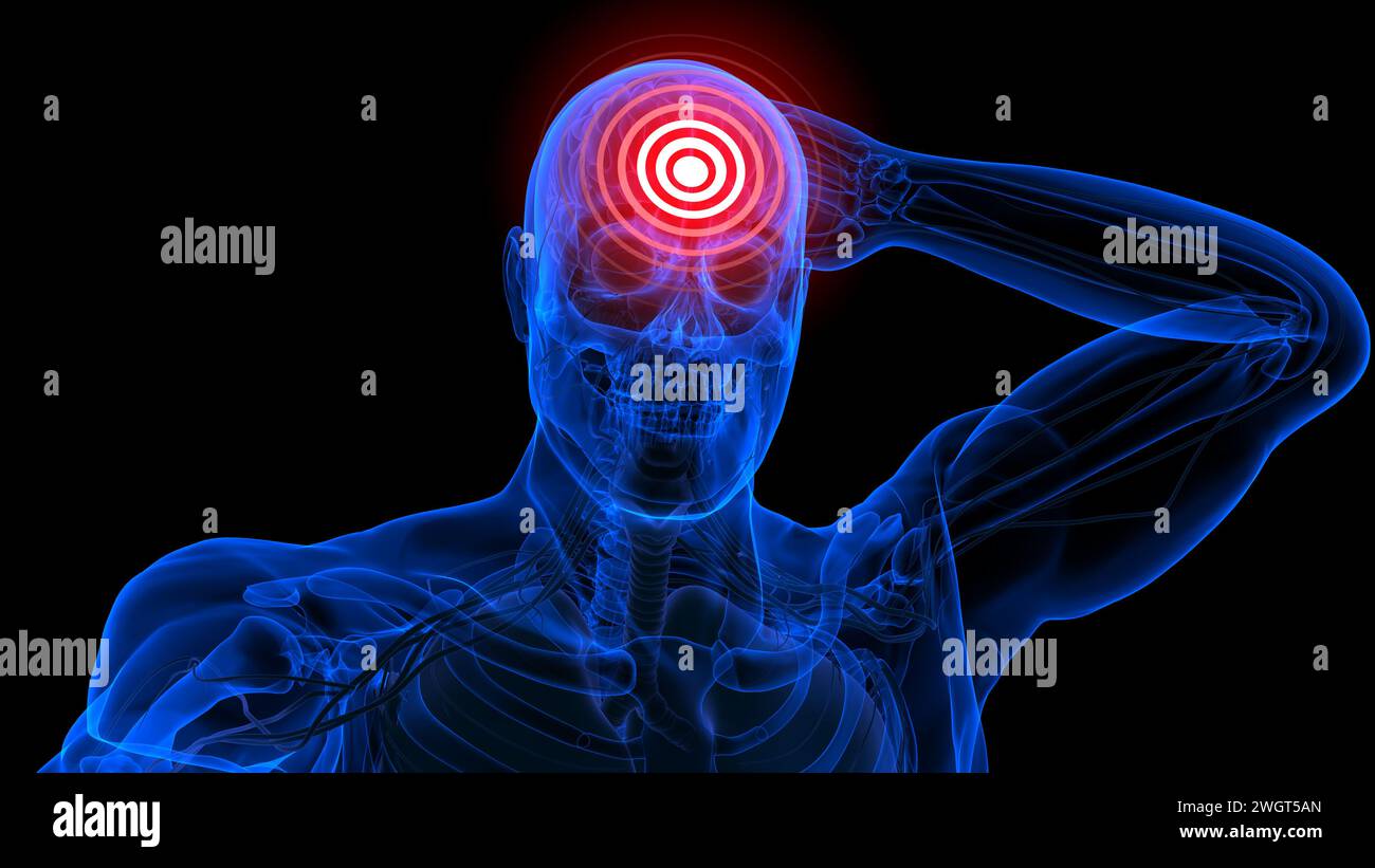 Feeling headache anatomy for medical concept 3D illustration Stock ...