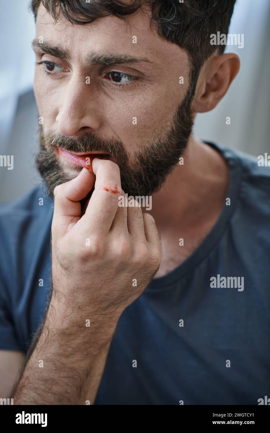 anxious depressed man in casual t shirt biting his lips till blood ...