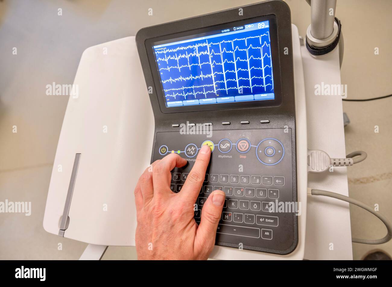 Electrocardiogram device with leads and findings Stock Photo - Alamy
