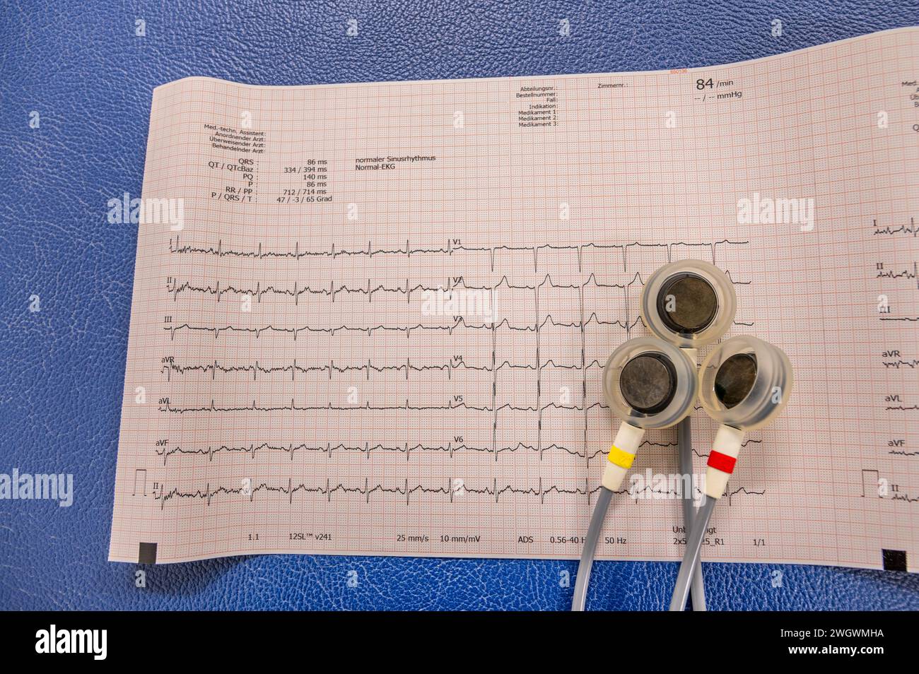 Electrocardiogram device with leads and findings Stock Photo - Alamy