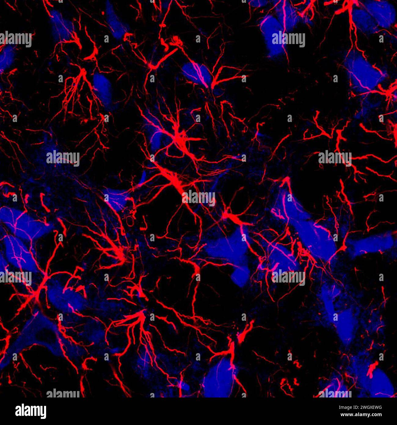Astrocytes hi-res stock photography and images - Alamy