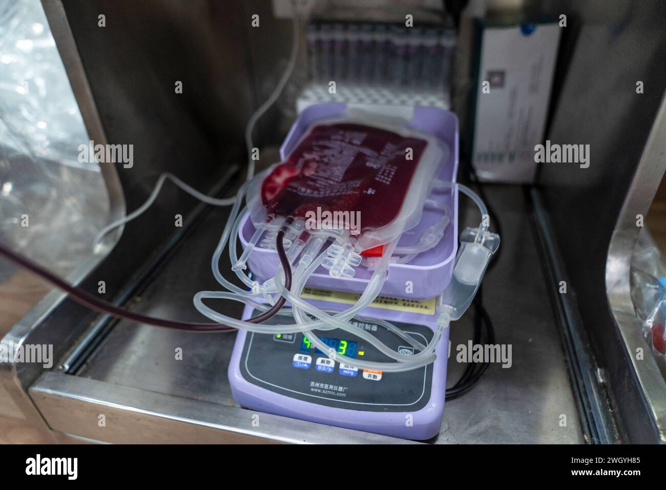 ENSHI, CHINA - FEBRUARY 1, 2024 - Blood collection bags swing on the ...