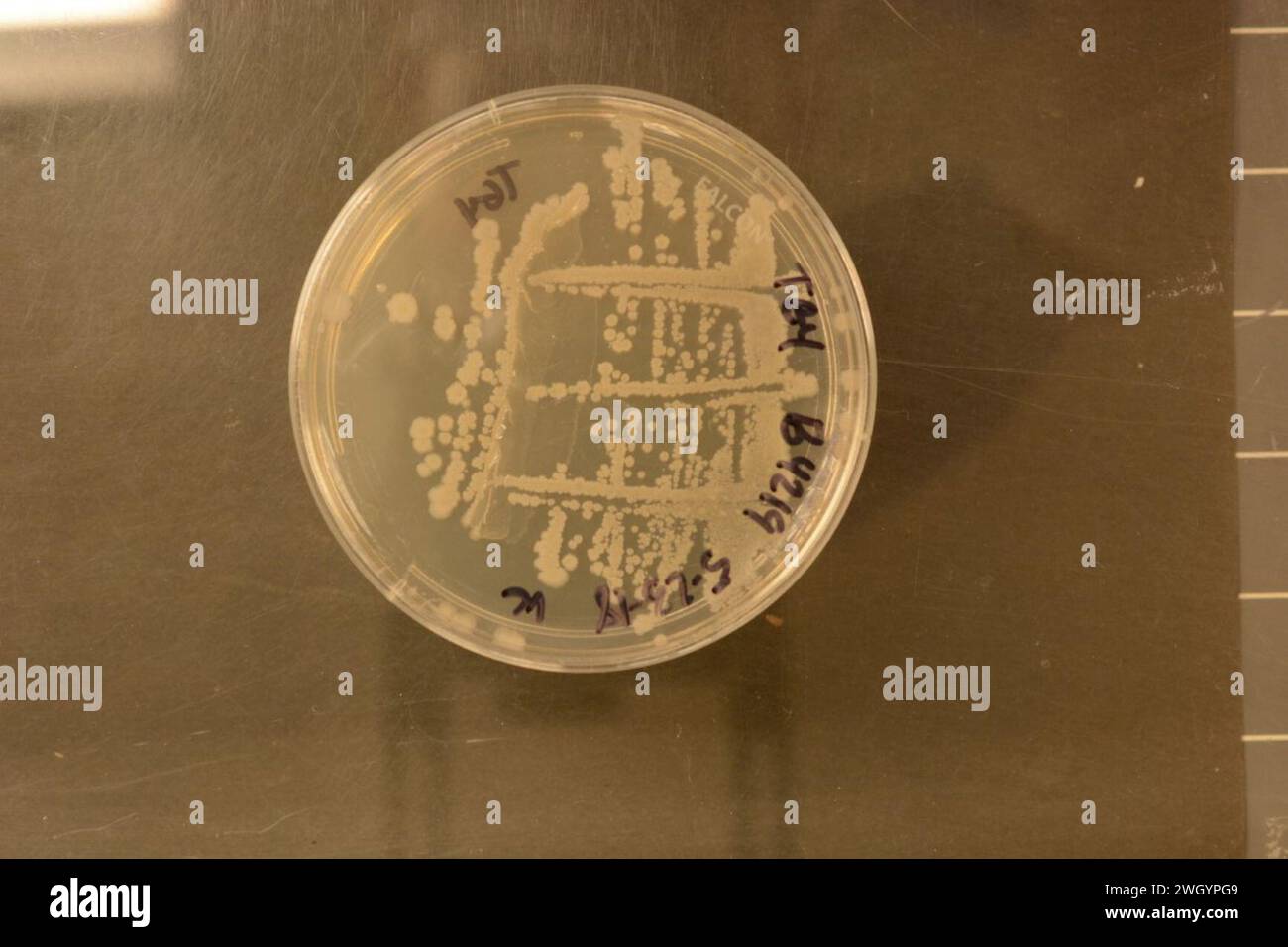 Bacillus subtilis hi-res stock photography and images - Alamy