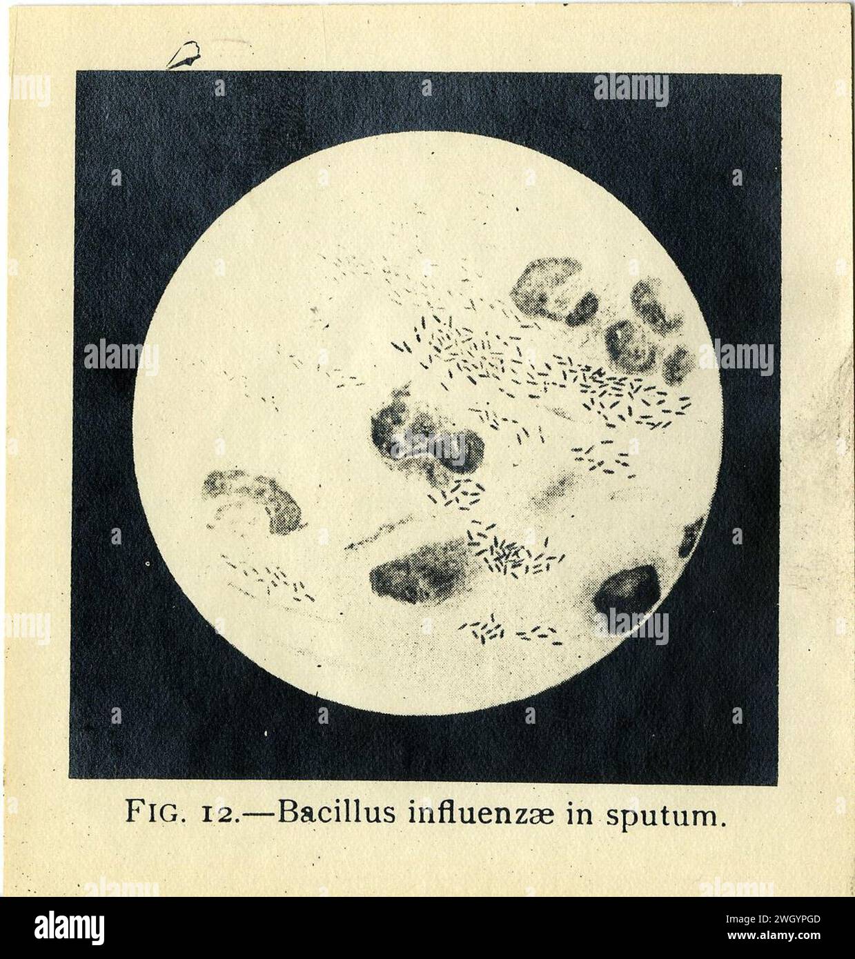 Bacillus influenza in sputum Stock Photo - Alamy