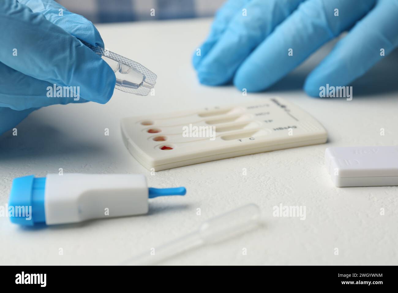 Doctor dropping buffer solution onto disposable multi-infection express ...