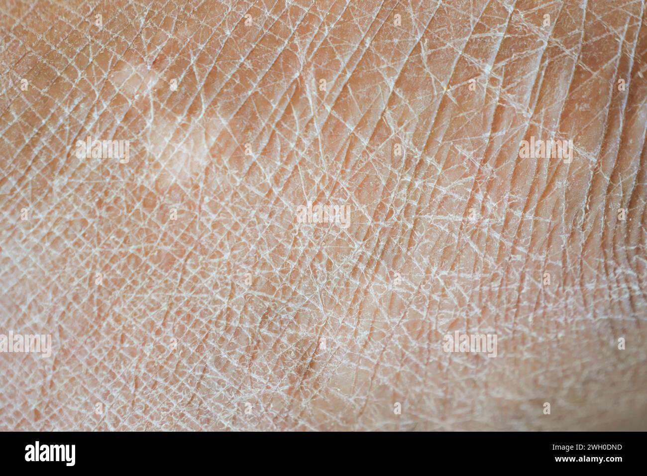 Closeup view woman normal hi-res stock photography and images - Alamy