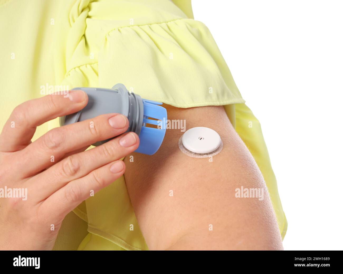 Diabetic woman with glucose sensor on white background, closeup Stock ...