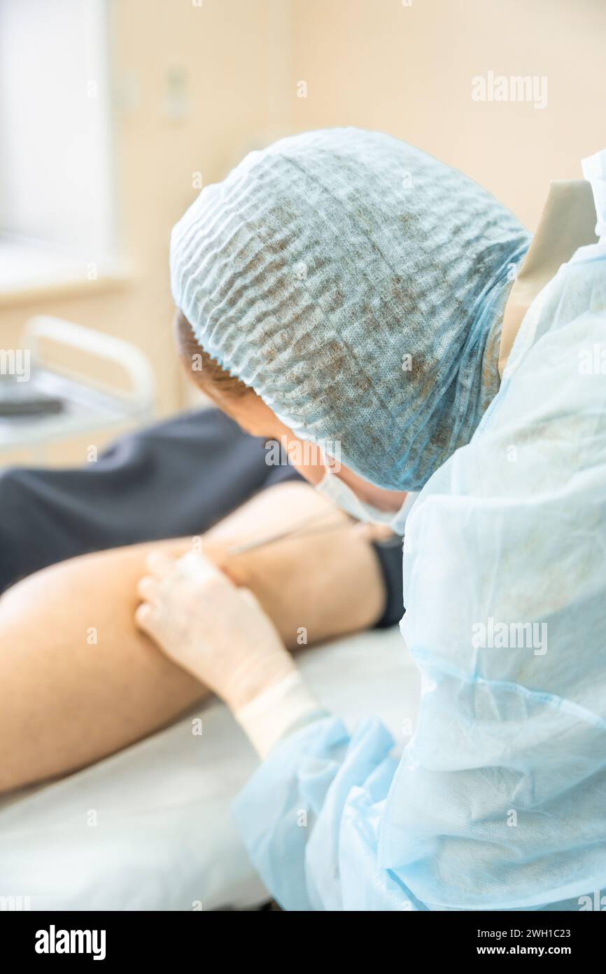 Dermatologist surgeon woman removes skin diseases, operation process ...