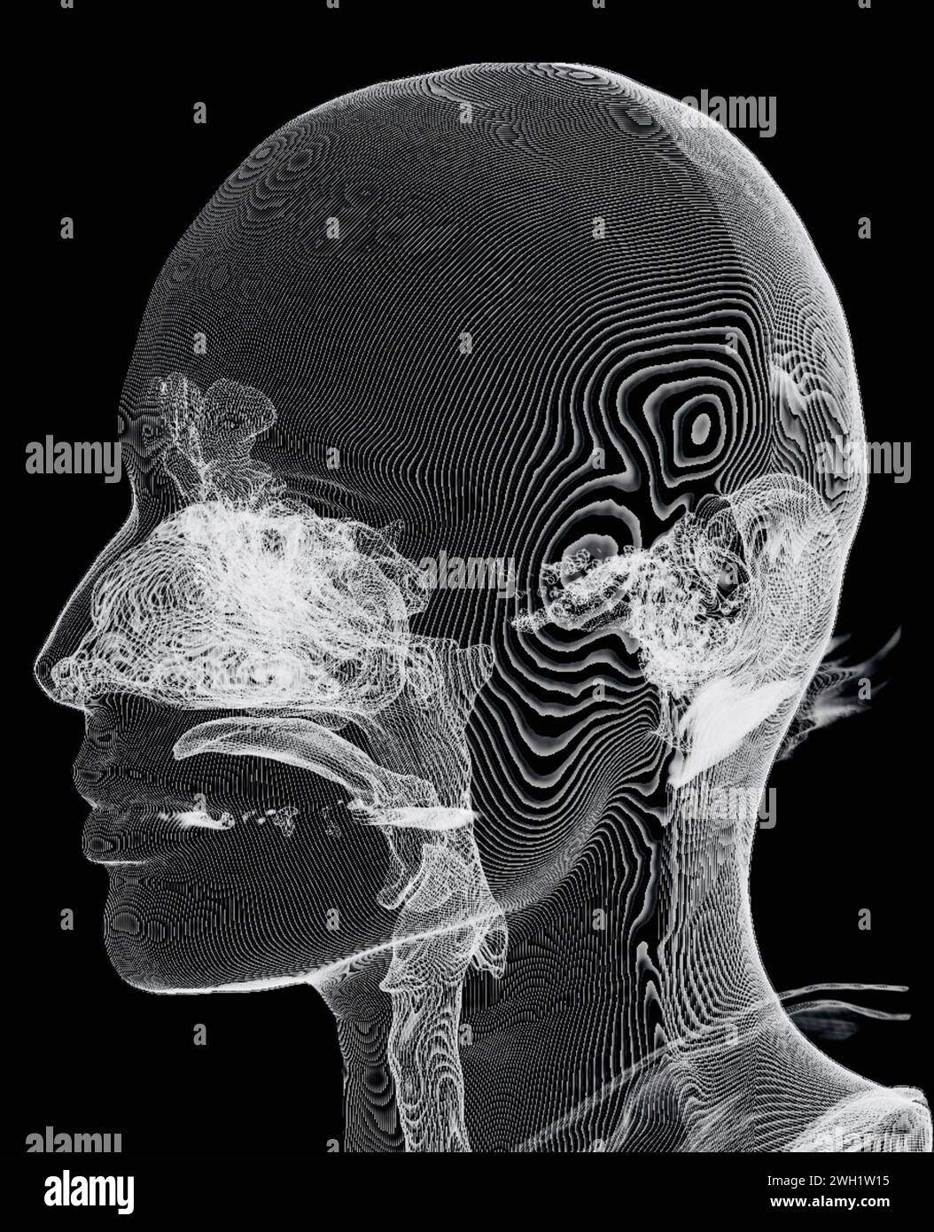 Upper airway and ear, CT scan Stock Photo - Alamy