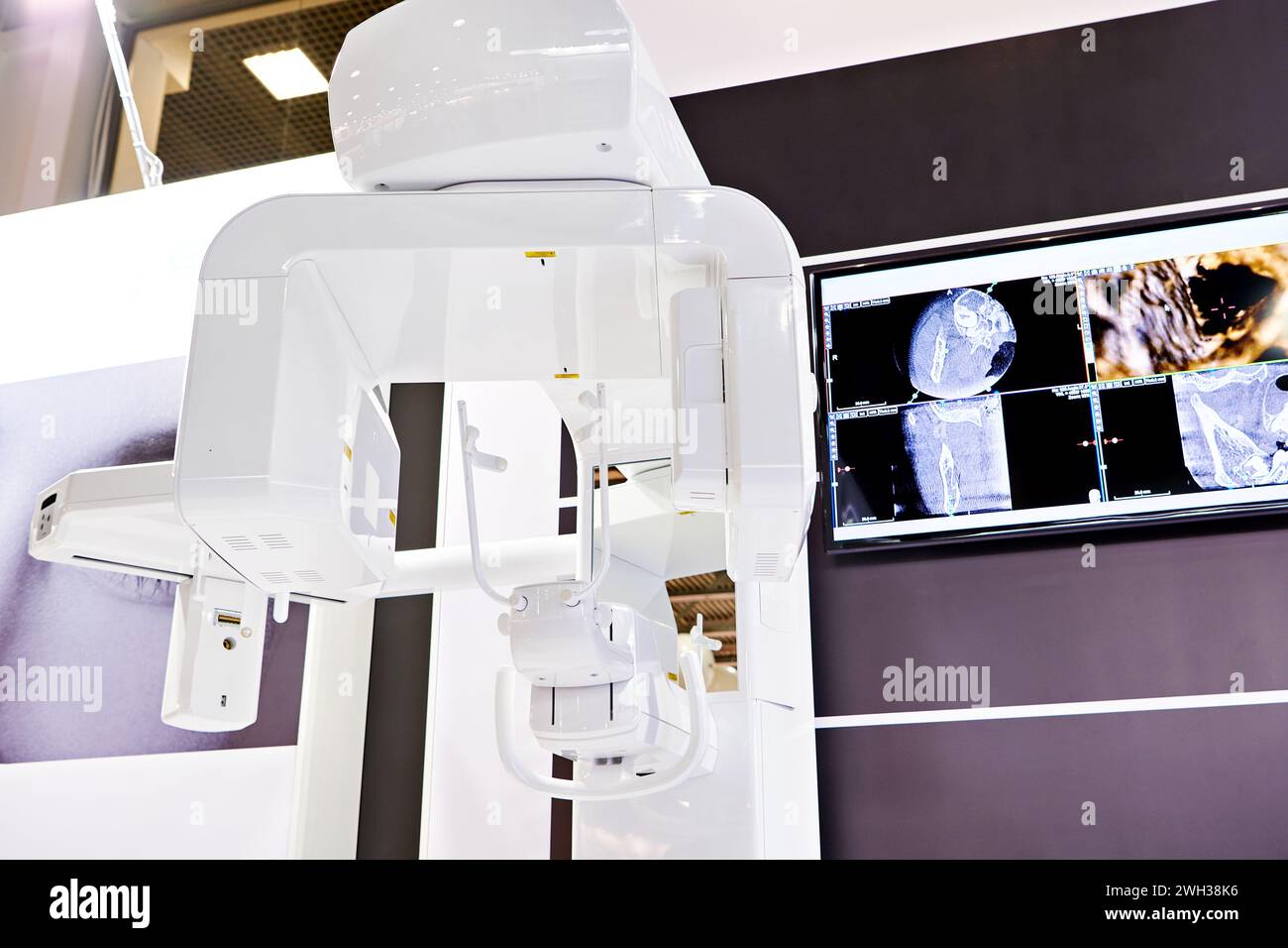 Radiography dental scan hi-res stock photography and images - Alamy