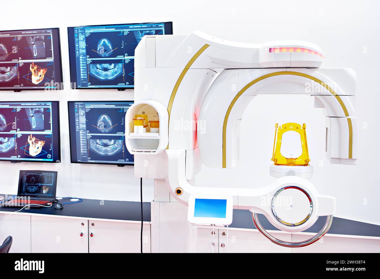 Computer dental tomograph on exhibition Stock Photo - Alamy