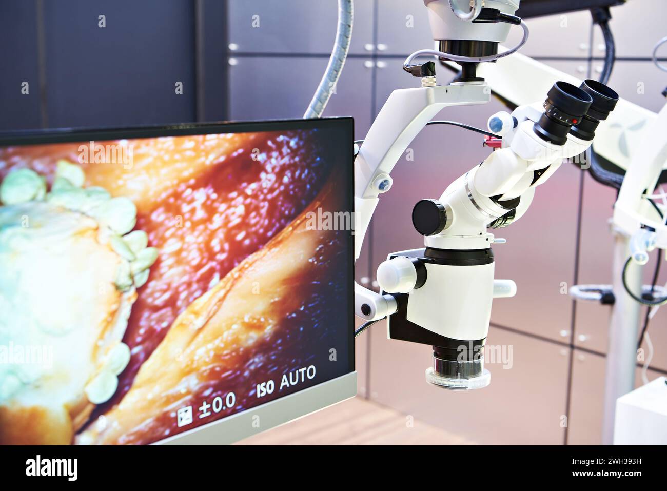 Dental surgical microscope with monitor Stock Photo - Alamy