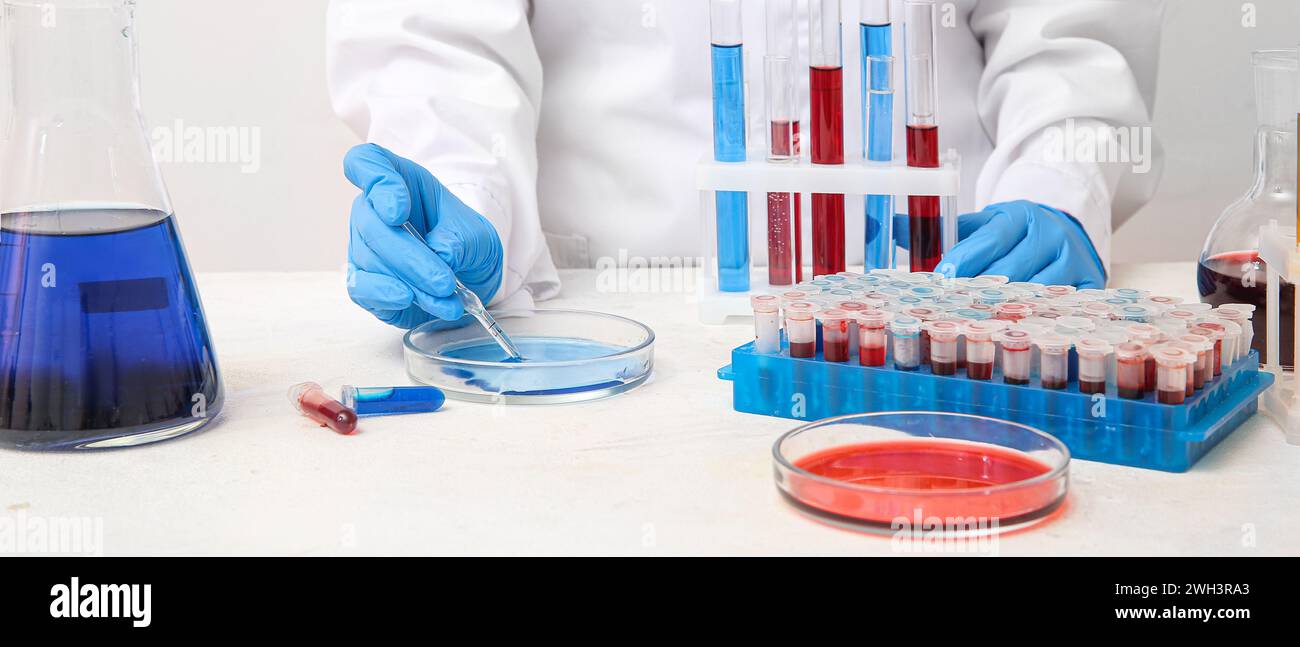 Female scientist dripping samples in petri dish at laboratory, closeup ...