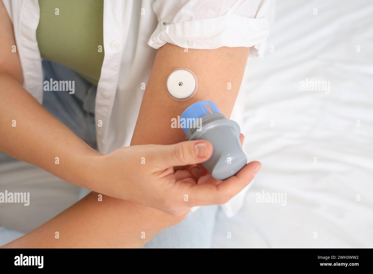 Diabetic woman with glucose sensor measuring blood sugar level in ...