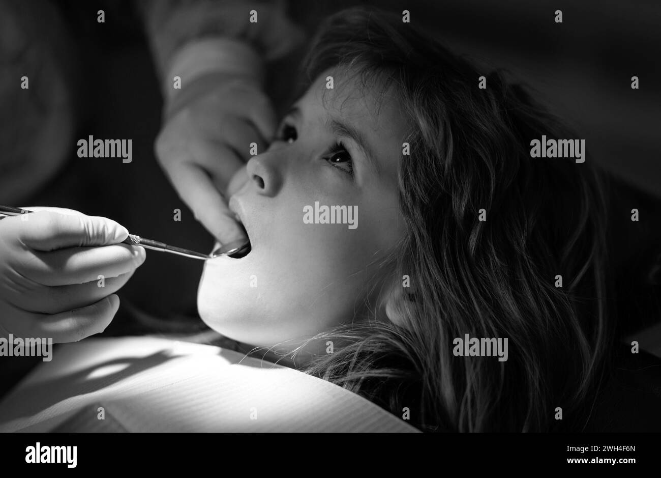 Teeth checkup at dentists, examining teeth close up. Dentist examining ...