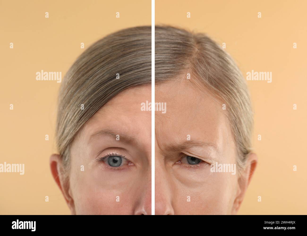 Aging skin changes. Woman showing face before and after rejuvenation ...