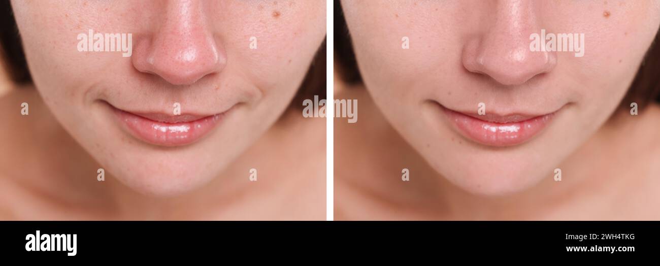 Aging skin changes. Woman showing face before and after rejuvenation ...