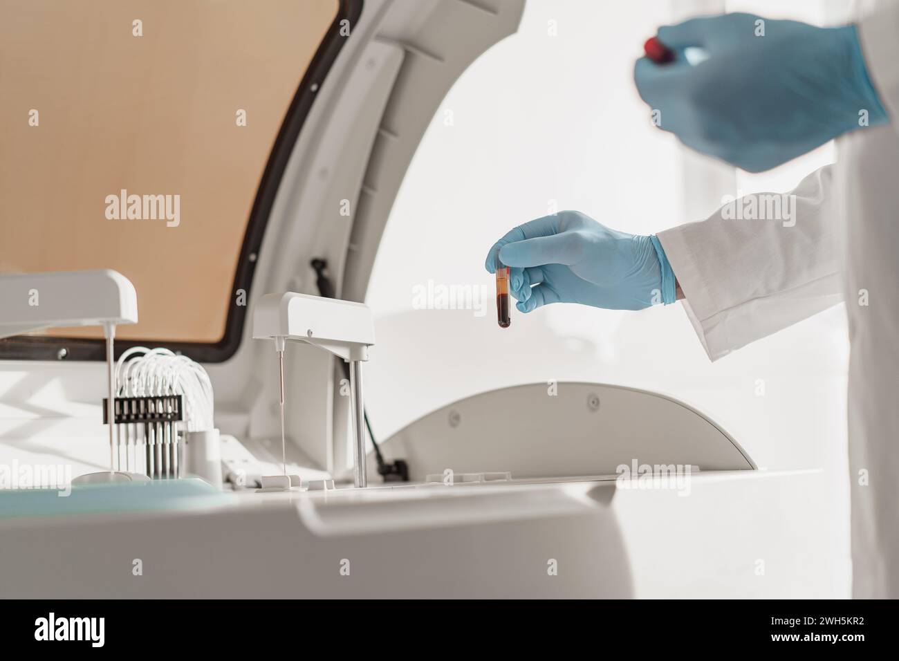 Close up of researcher hand in sterile glove putting test tube into ...