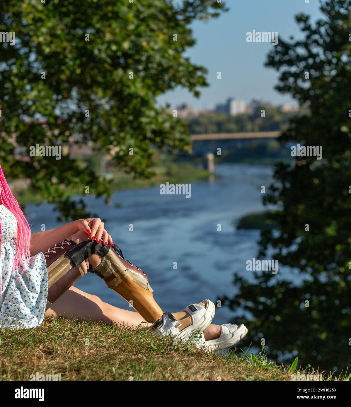 Amputee woman one leg hi-res stock photography and images - Alamy