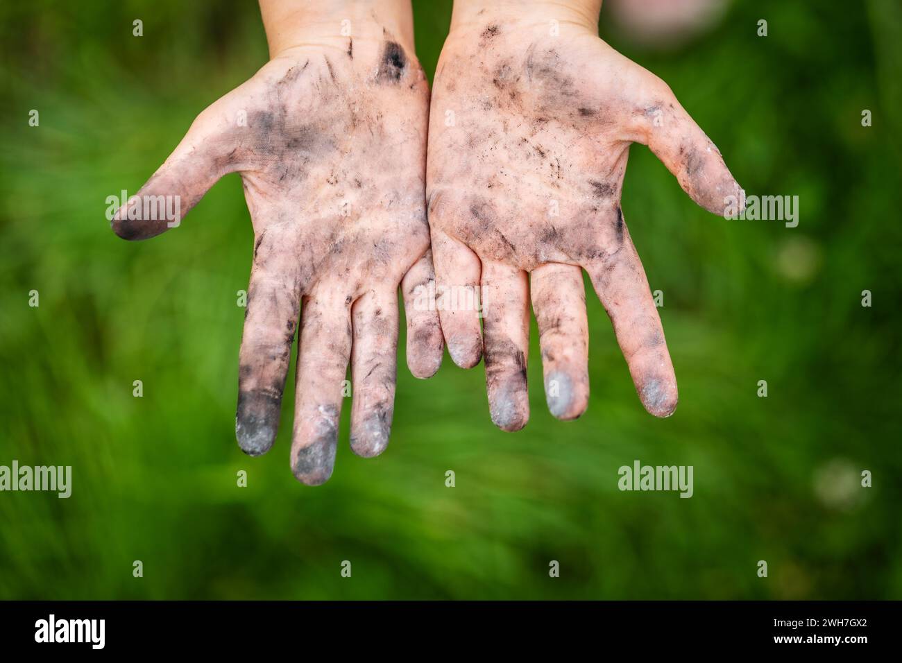 A little girl shows her filthy hands stained with black ash from ...
