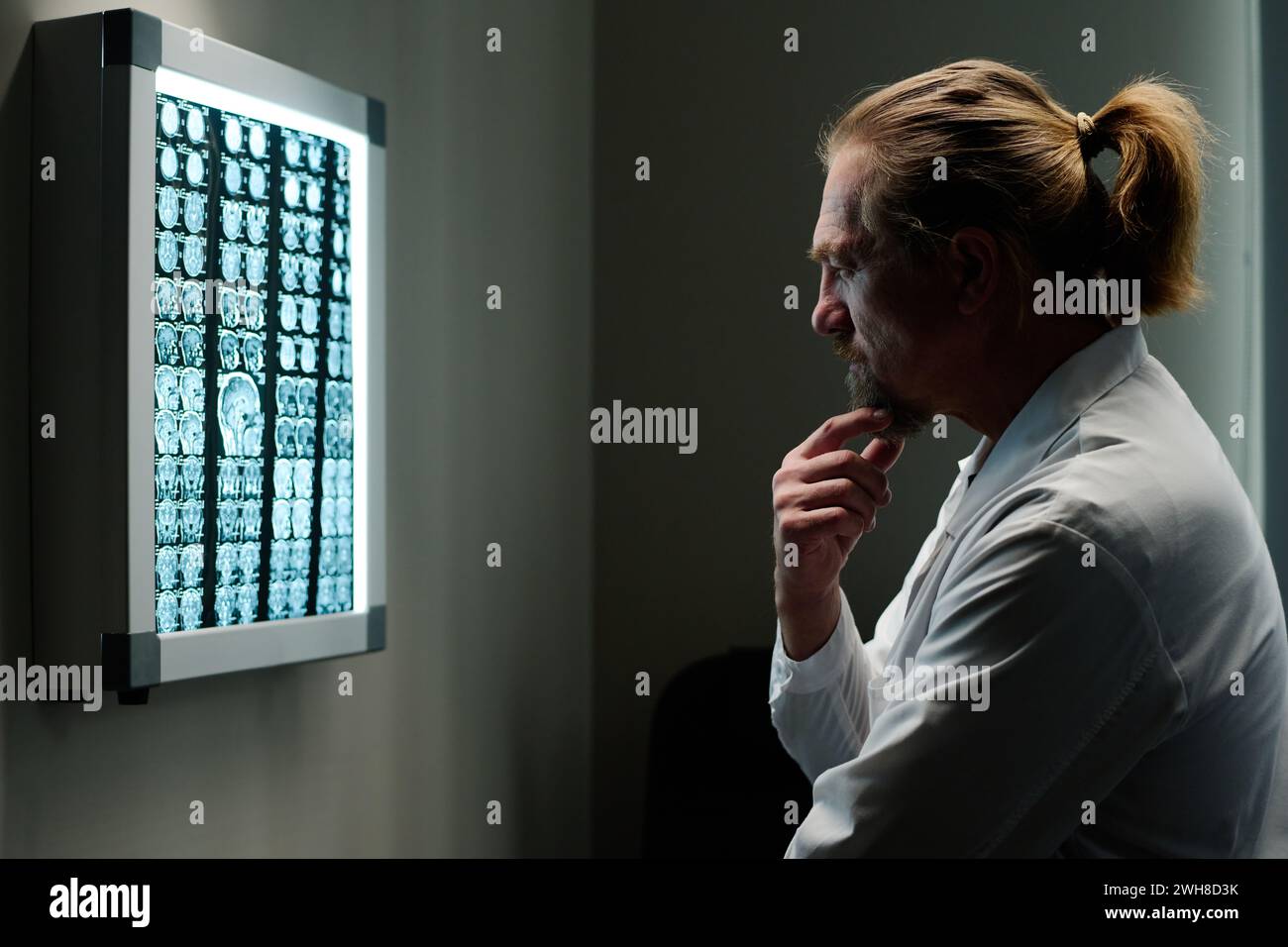 Experienced pensive radiologist with hand by beard looking at ct brain ...