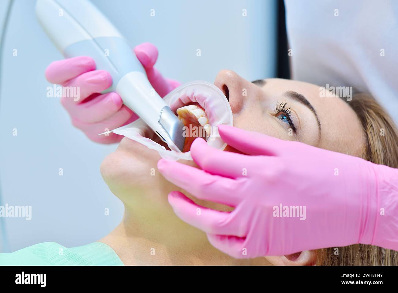 Human healthy intraoral teeth hi-res stock photography and images - Alamy