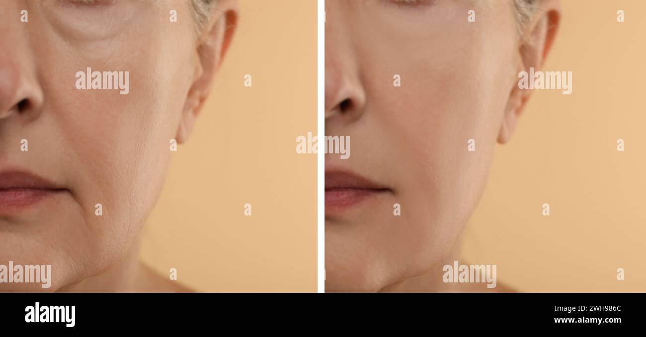 Aging skin changes. Woman showing face before and after rejuvenation ...