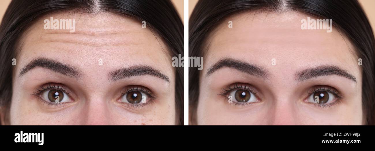 Aging skin changes. Woman showing face before and after rejuvenation ...