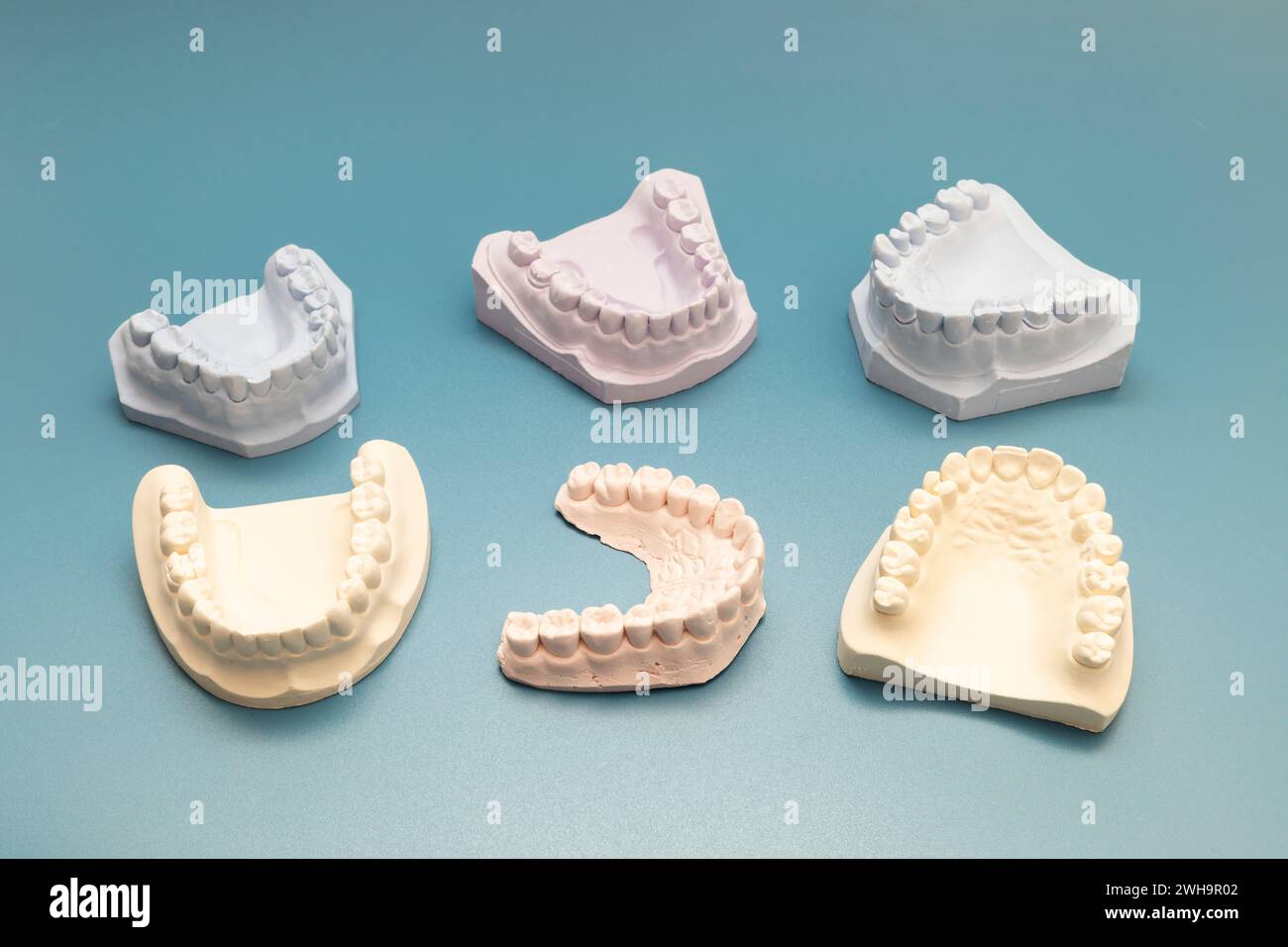 Many Die Stone, Plaster Cast Molds Of The Upper And Lower Jaws And ...