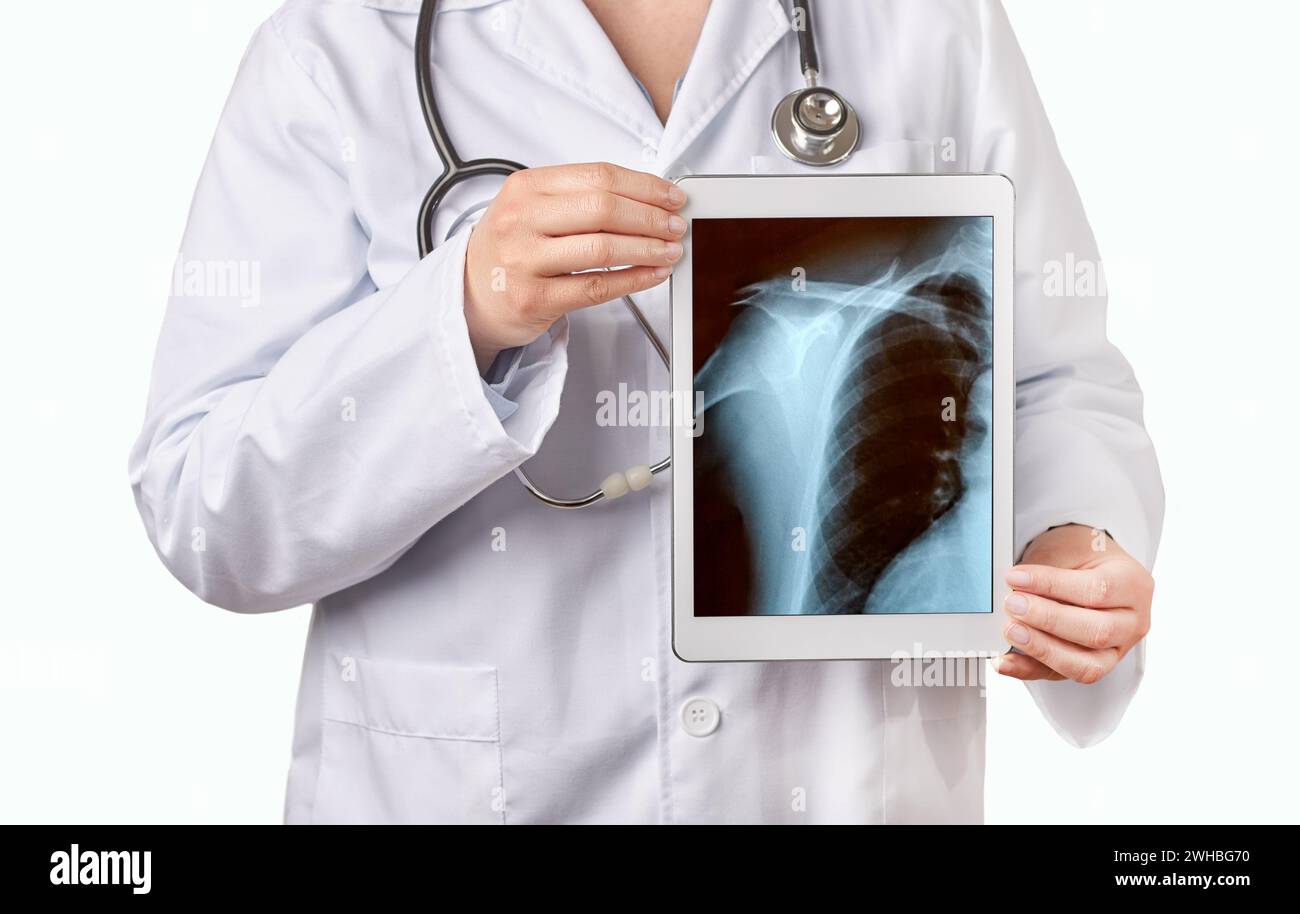 Female doctor with showing a digital tablet with x-ray of a shoulder on ...