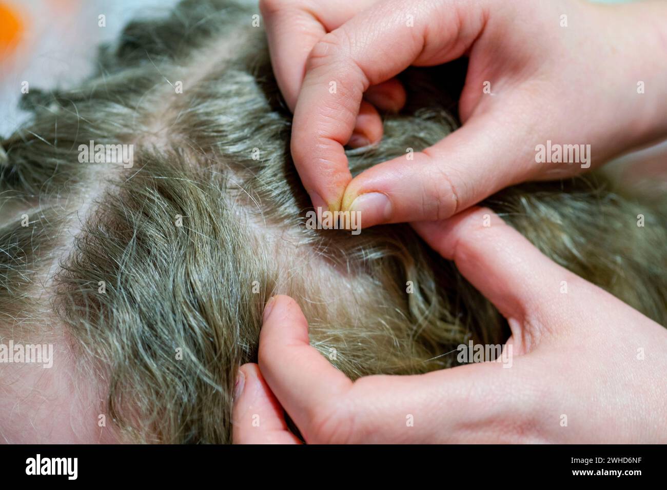 louse on head a little girl. Mother checking childs head for lice ...