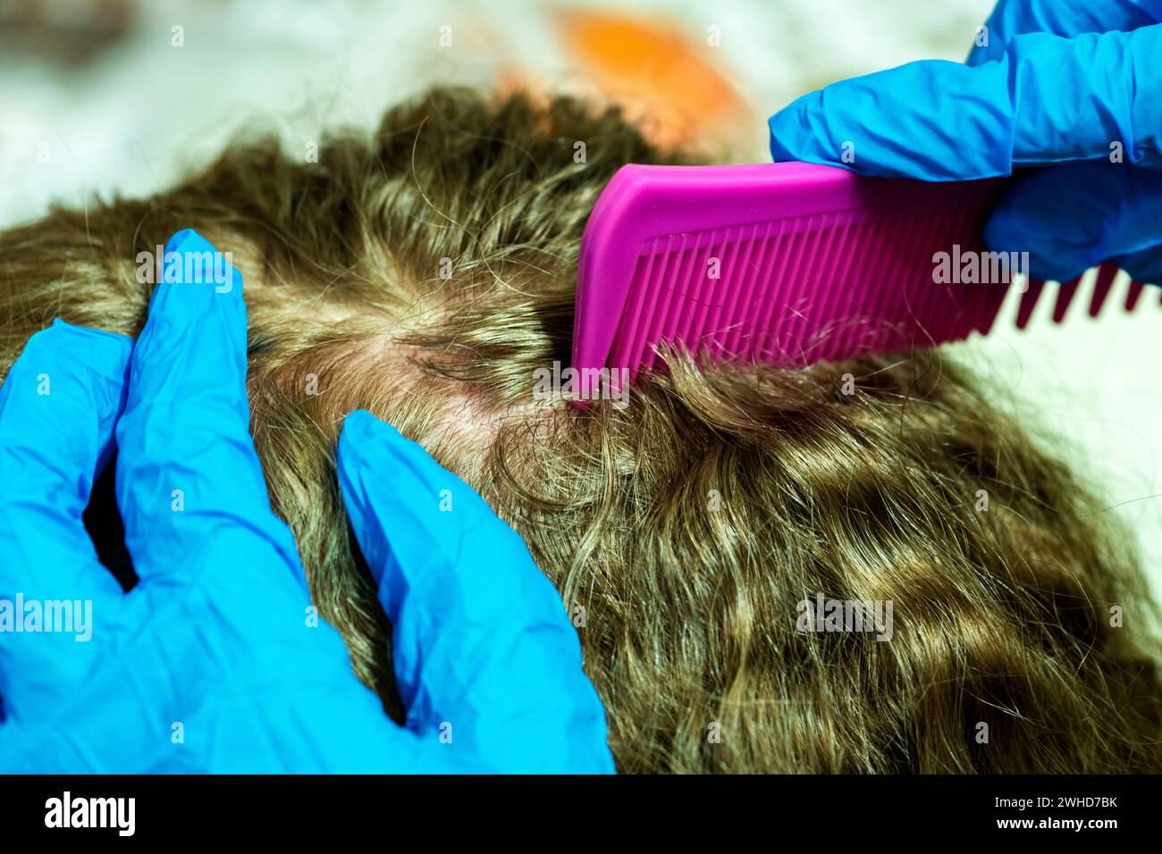 louse on head a little girl. checking childs head for lice with a comb ...