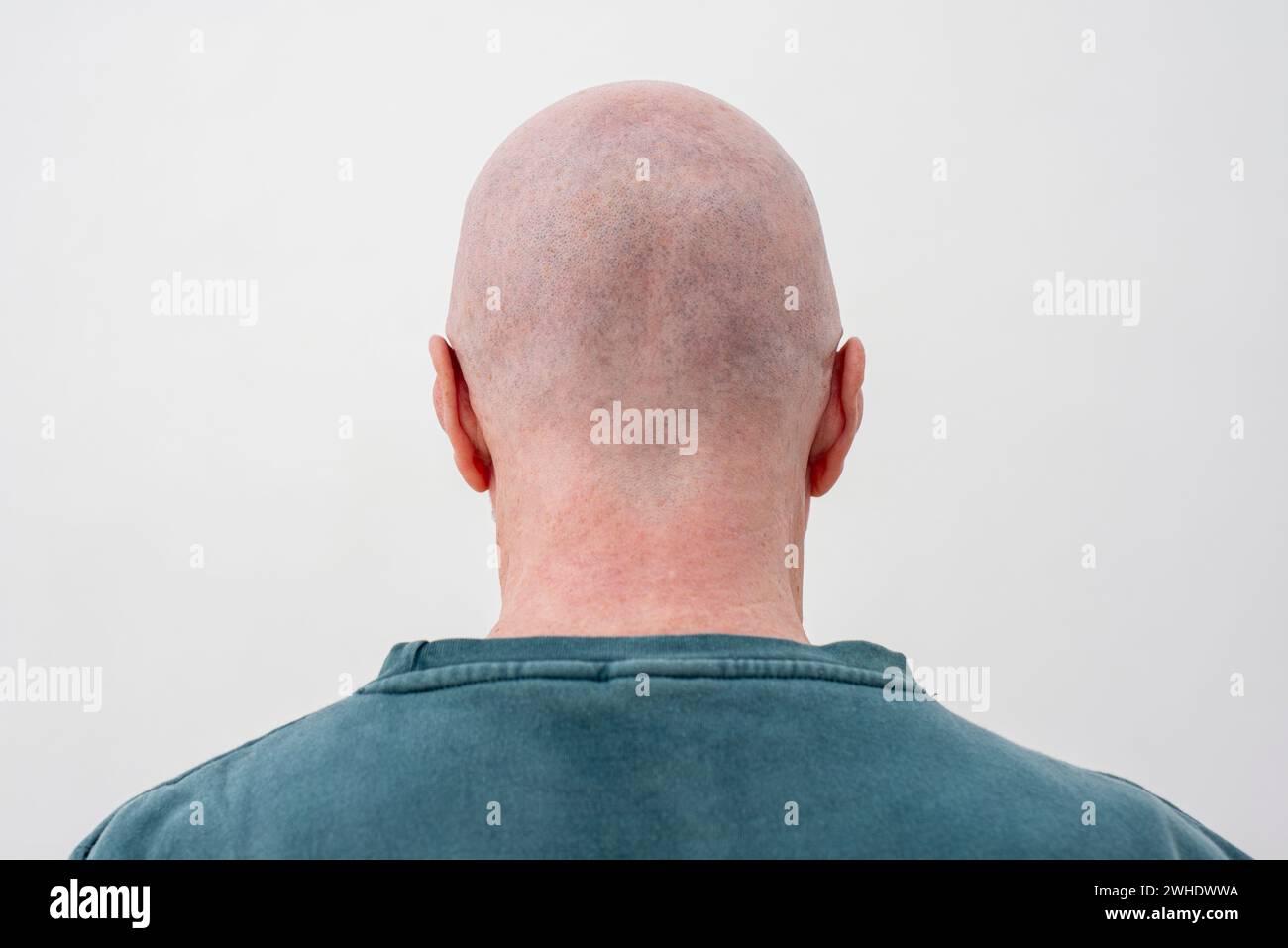 Bald man back of head hi-res stock photography and images - Alamy