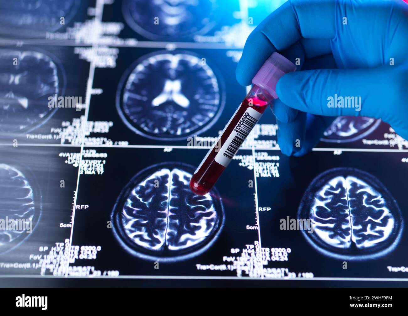 Brain research, conceptual image Stock Photo - Alamy