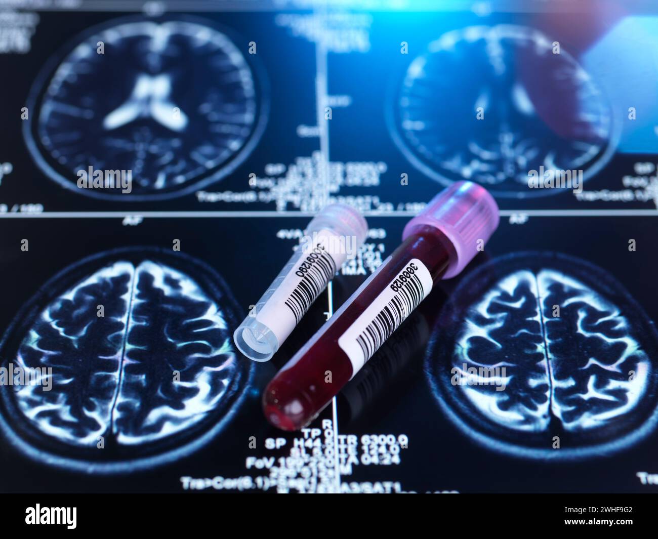 Diagnosing dna hi-res stock photography and images - Alamy