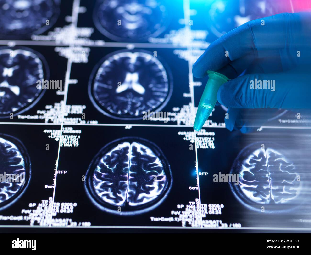 Diagnosing dna hi-res stock photography and images - Alamy